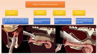 Artificial insemination & embryo transfer | PPS