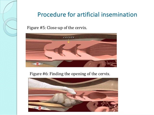 Artificial insemination in cattle