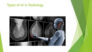 ARTIFICIAL INTELLIGENCE(AI) IN RADIOLOGY.pptx