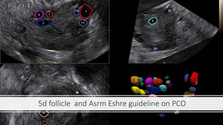 Artificial intelligence and reproductive Medicine.pptx