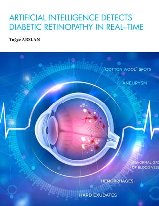 Artificial Intelligence Detects Diabetic Retinopathy In Real Time | PDF