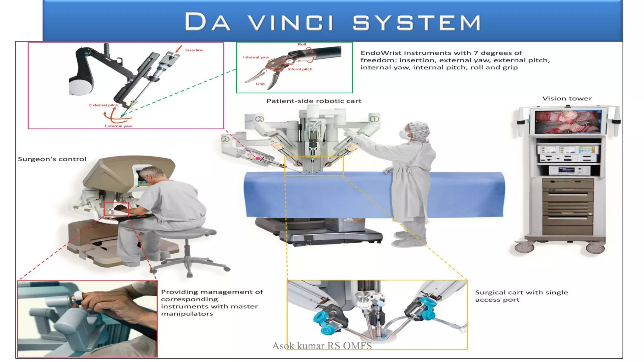 Artificial intelligence in omfs | PDF