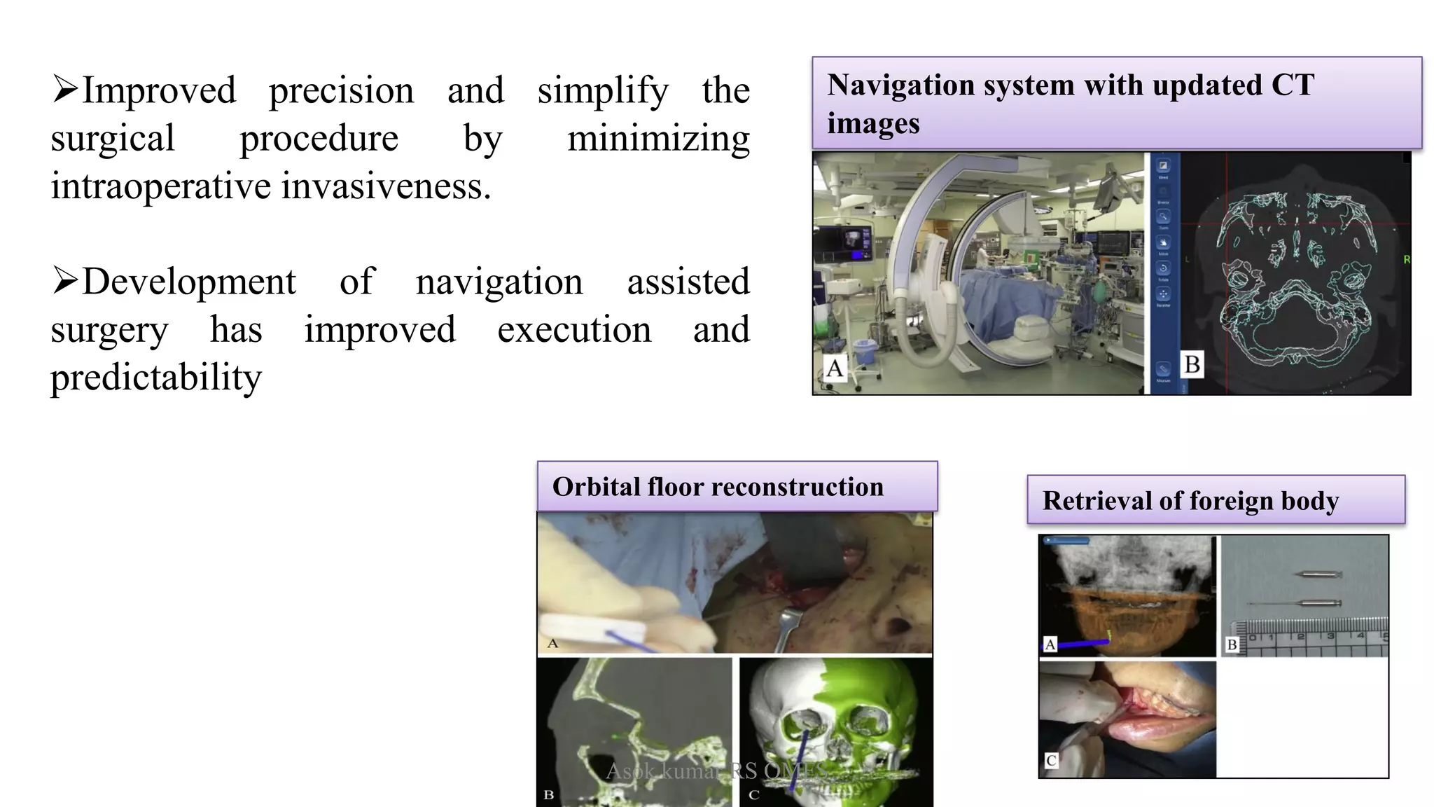 Artificial intelligence in omfs | PDF