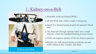 Artificial kidney | PPTX