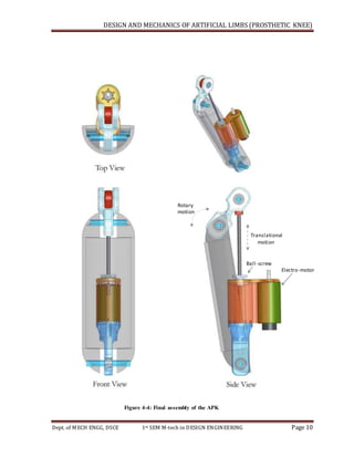 Artificial limbs report | DOCX