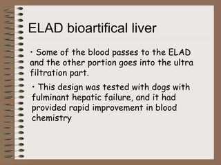 Introduction to Bio-Artificial Livers: A Biomedical Engineering ...