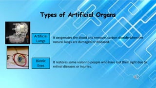 Artificial Organs And Prosthetics PPT=== | PPTX