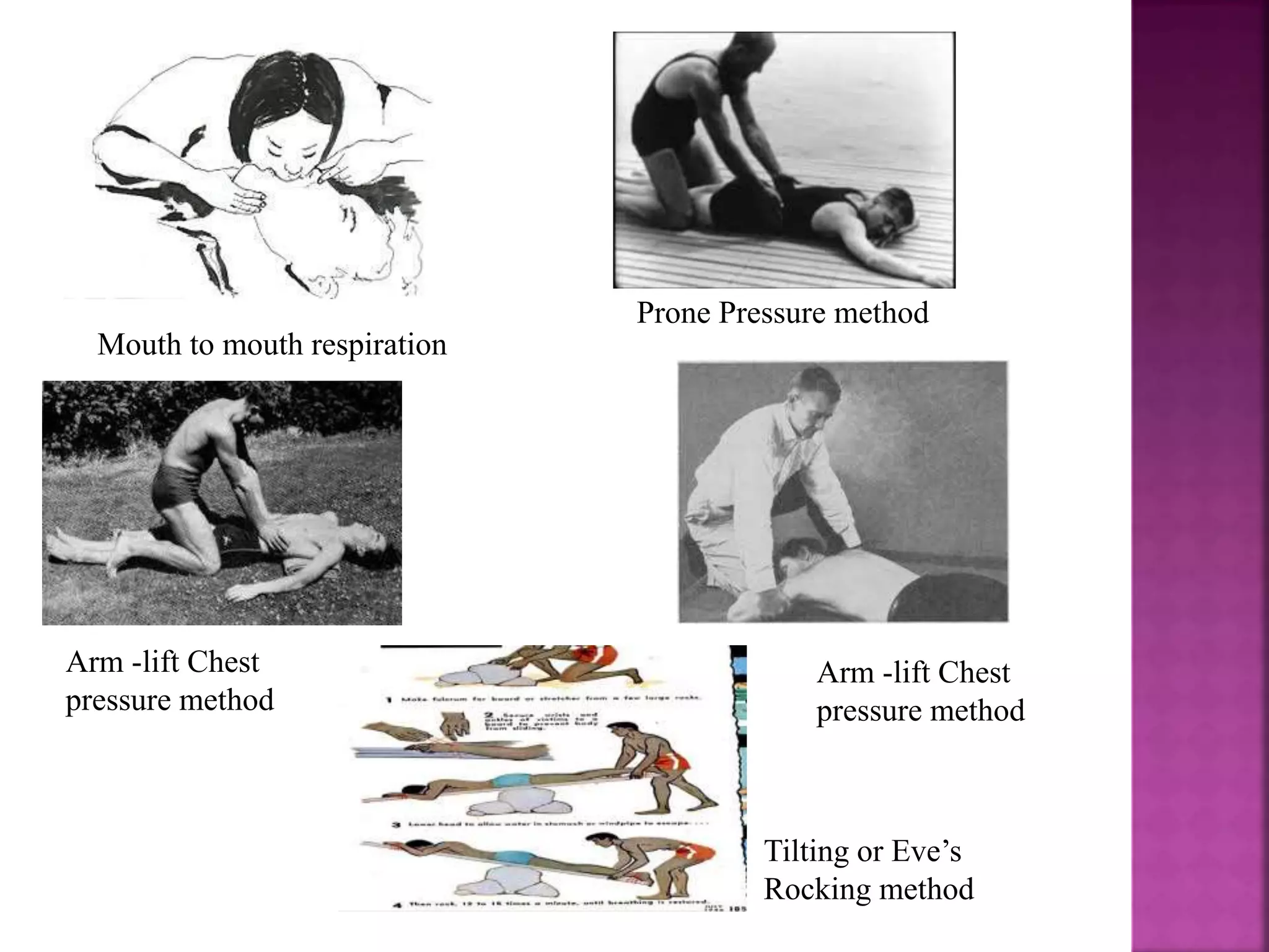 Artificial respiration | PPTX