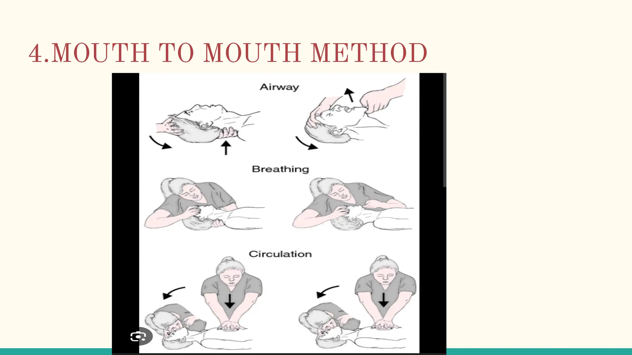 artificial respiration .pdf