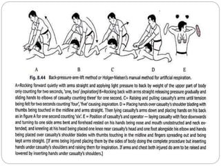 artificial respiration-ppt-200130073828.pdf