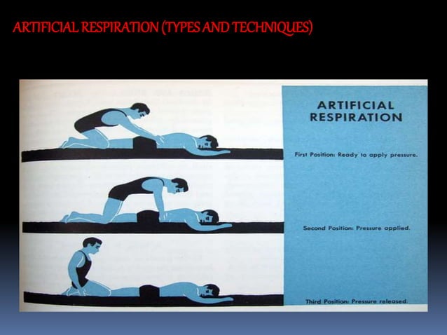 Artificial respiration and resuscitation methods | PPTX | First Aid ...