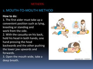 Artificial respiration and resuscitation methods | PPTX