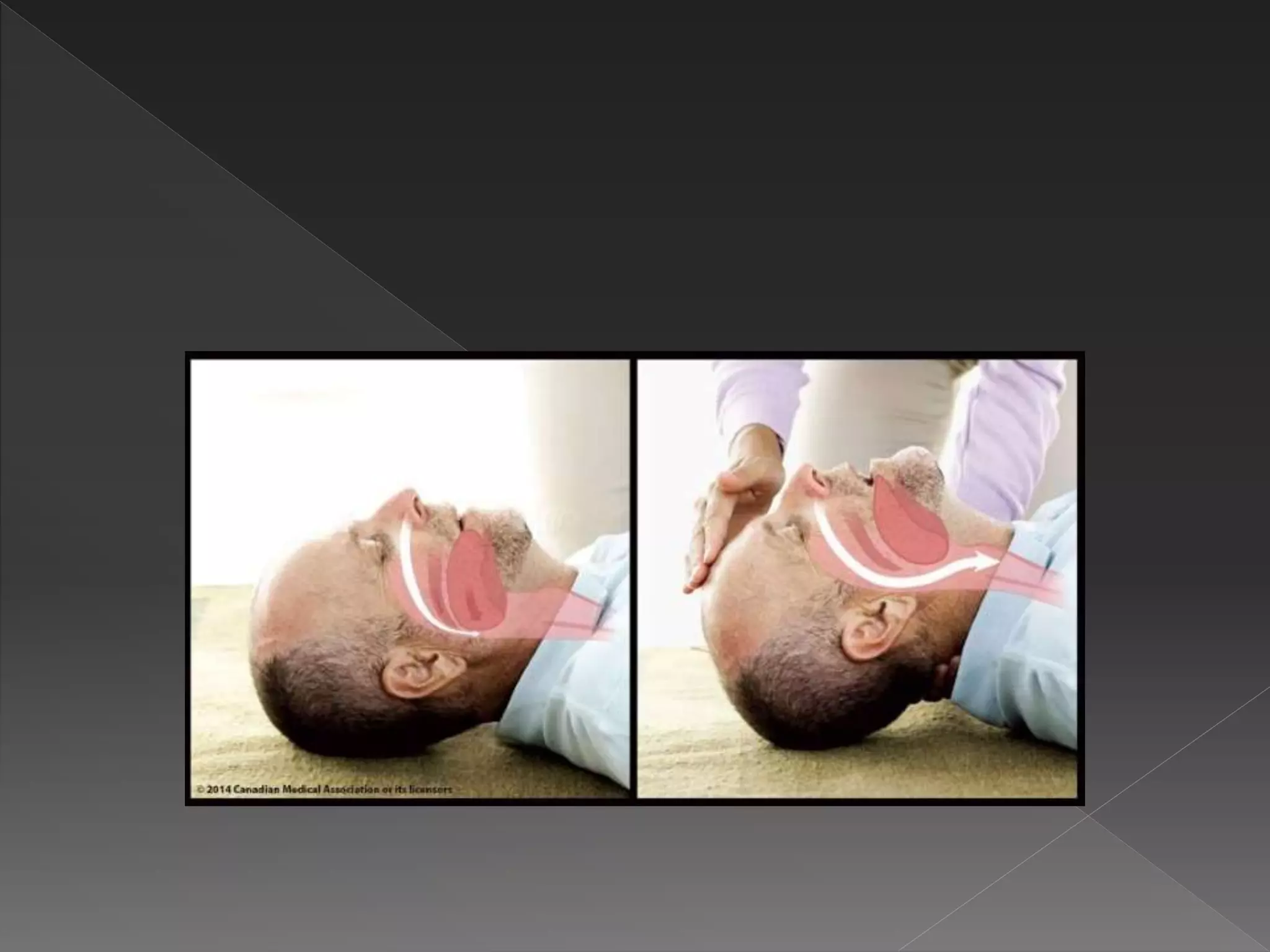 Artificial respiration & cpr | PPTX