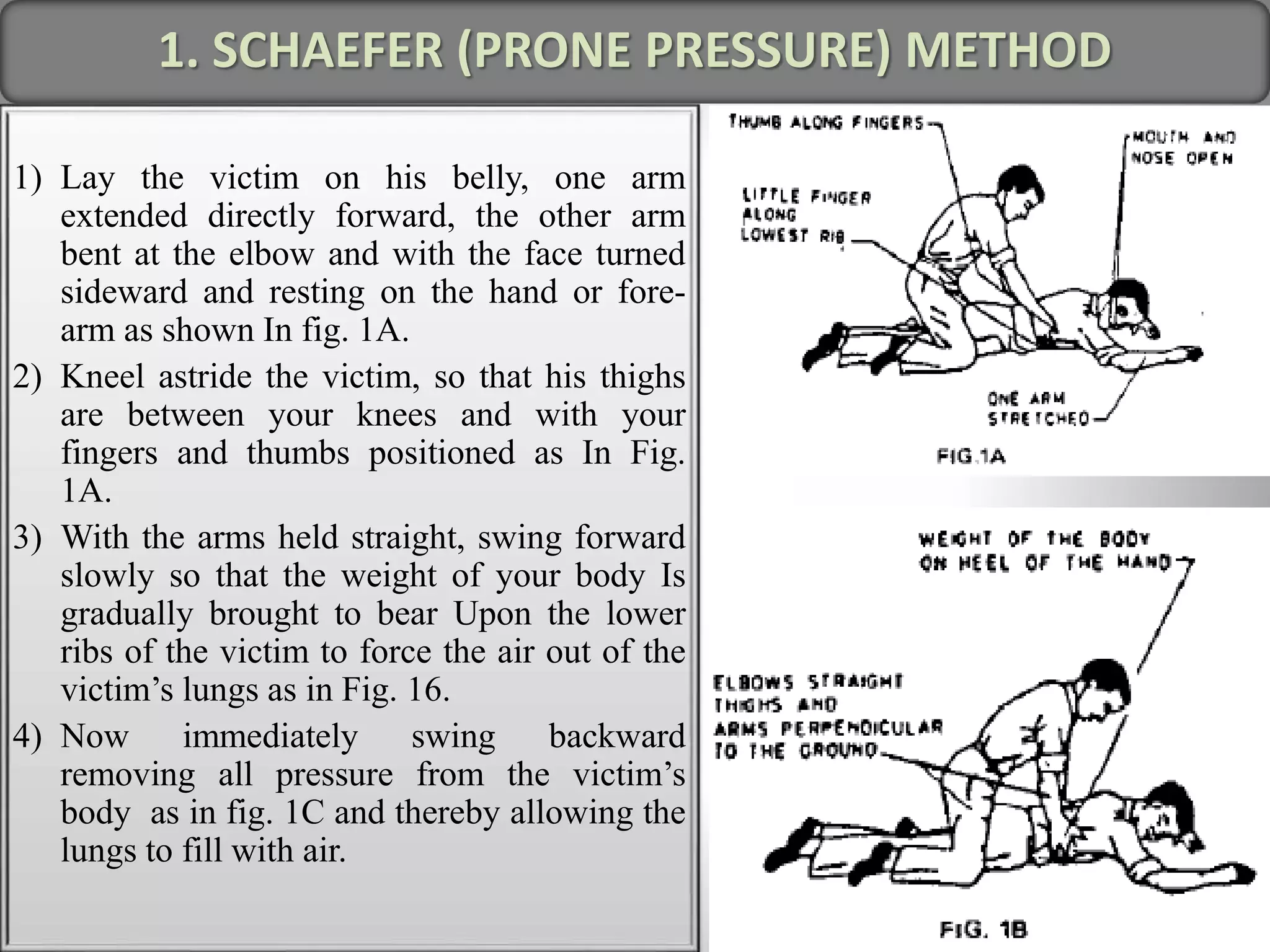 Artificial respiration method | PPTX