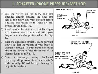 Artificial respiration method | PPTX