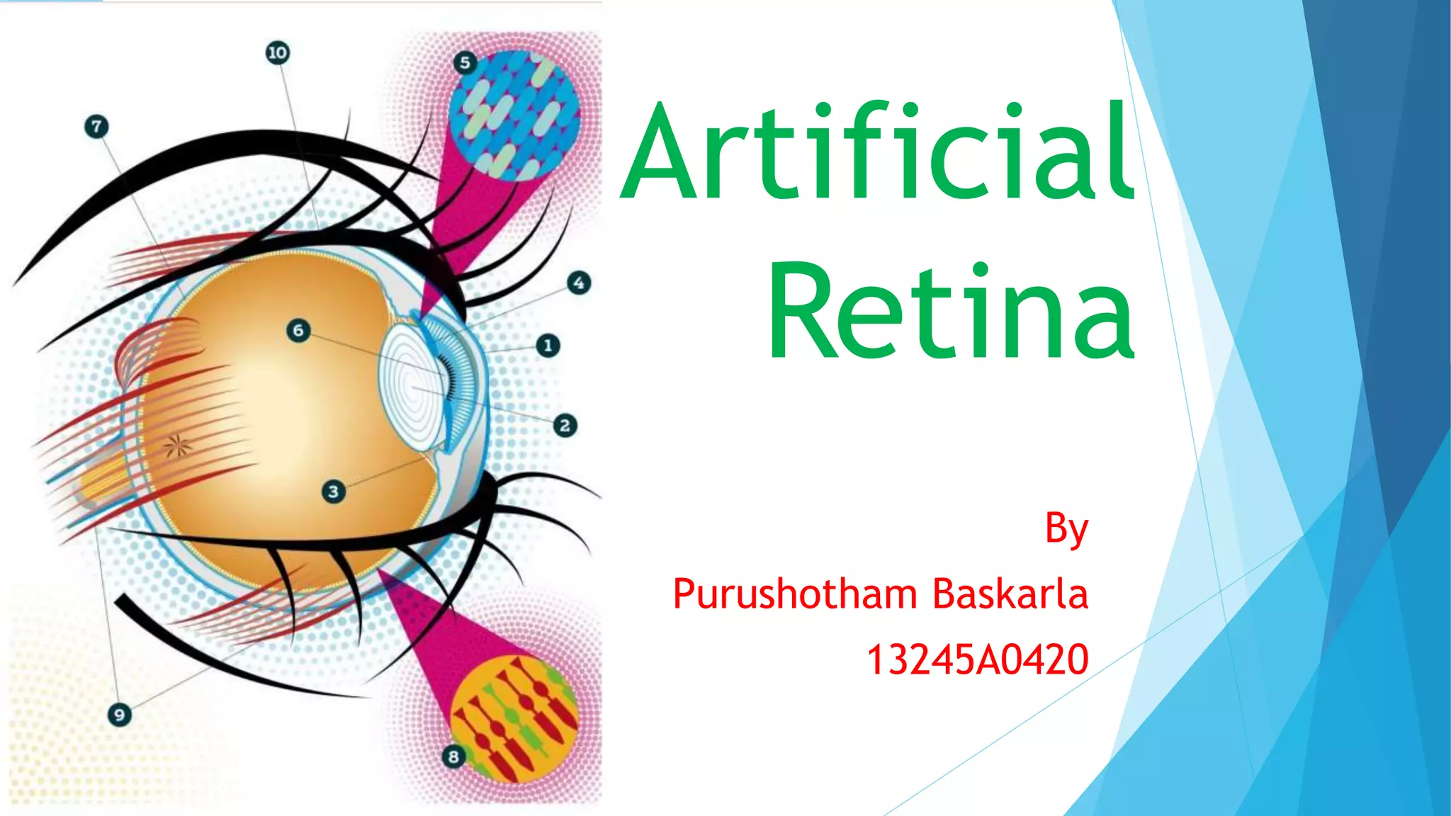 Artificial retina | PPTX