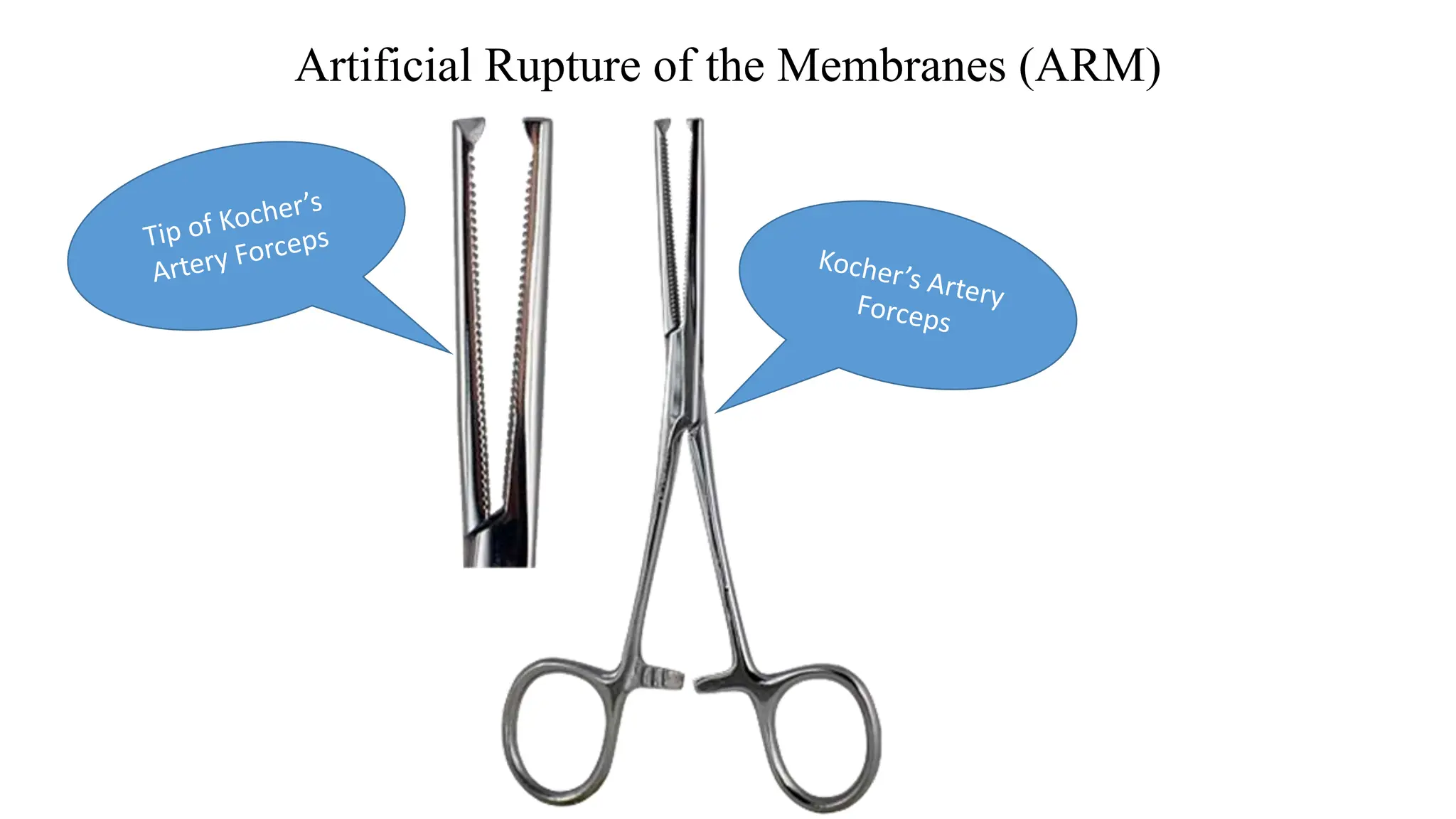 Artificial Rupture of Membrane during labor.pptx
