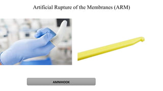 Artificial Rupture of Membrane during labor.pptx | Pregnancy ...