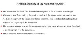 Artificial Rupture of Membrane during labor.pptx