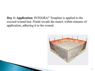 Artificial Skin.pptx