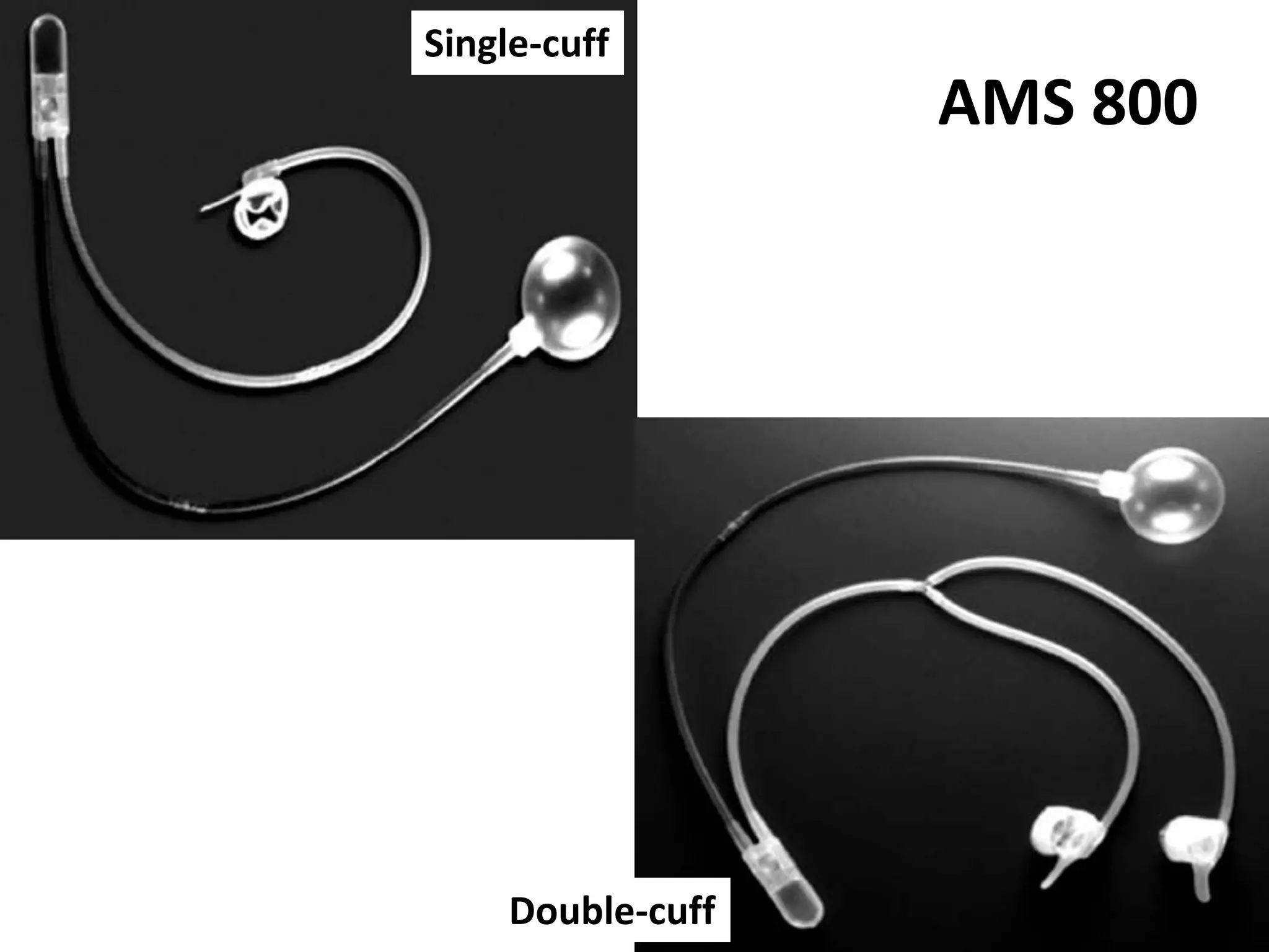 Artificial urinary sphincter - Operative | PPTX