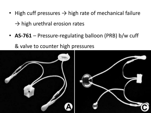 Artificial urinary sphincter - Operative | PPTX | Surgery | Medical Health