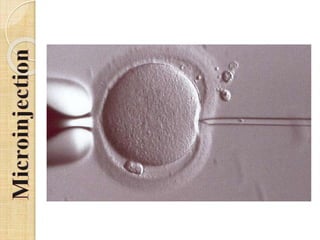 ARTIFICIAL VECTORLESS GENE TRANSFER METHODS | PPTX