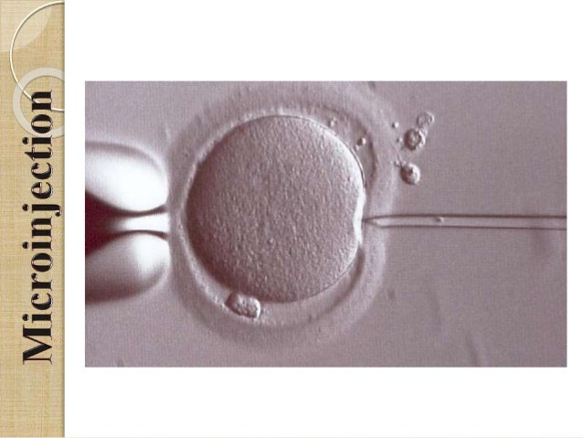 ARTIFICIAL VECTORLESS GENE TRANSFER METHODS