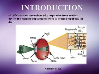 Artificial vision | PPSX
