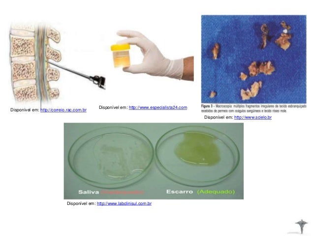 DIAGNÓSTICO LABORATORIAL DA CRIPTOCOCOSE