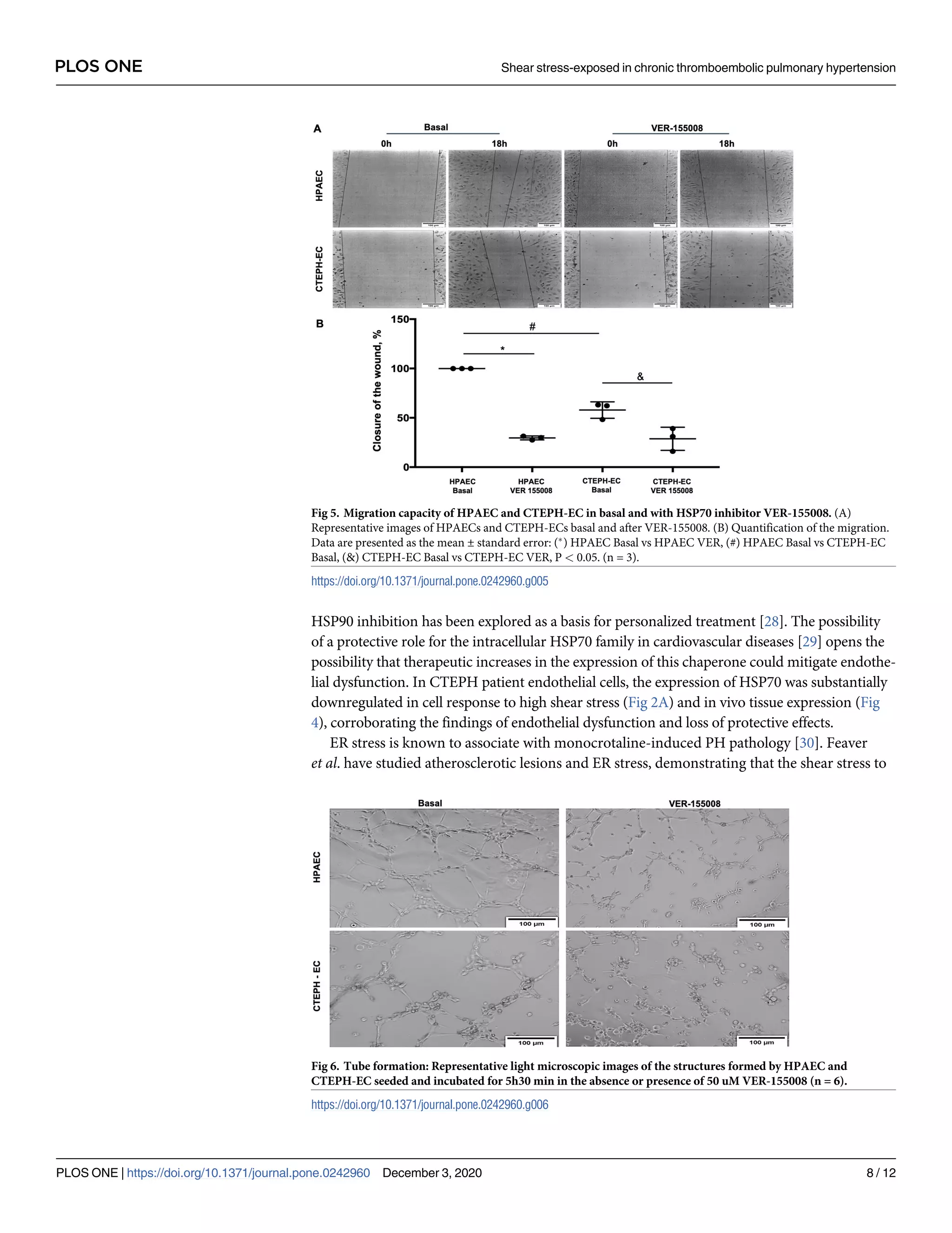 Shear stress-exposed pulmonary artery endothelial cells fail to ...