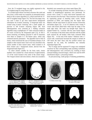 Master research article | PDF | Brain and Nervous System Disorders ...