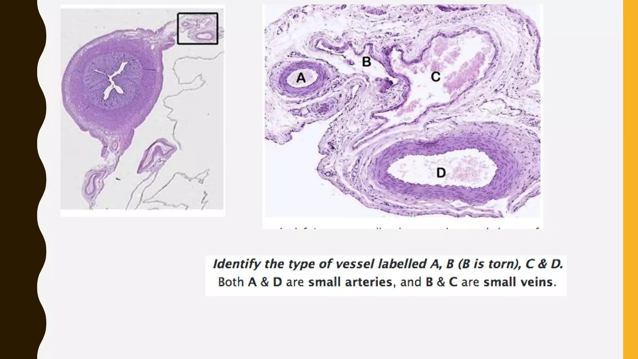 ARTERIES, VENULES, CAPILLARIES | PPTX