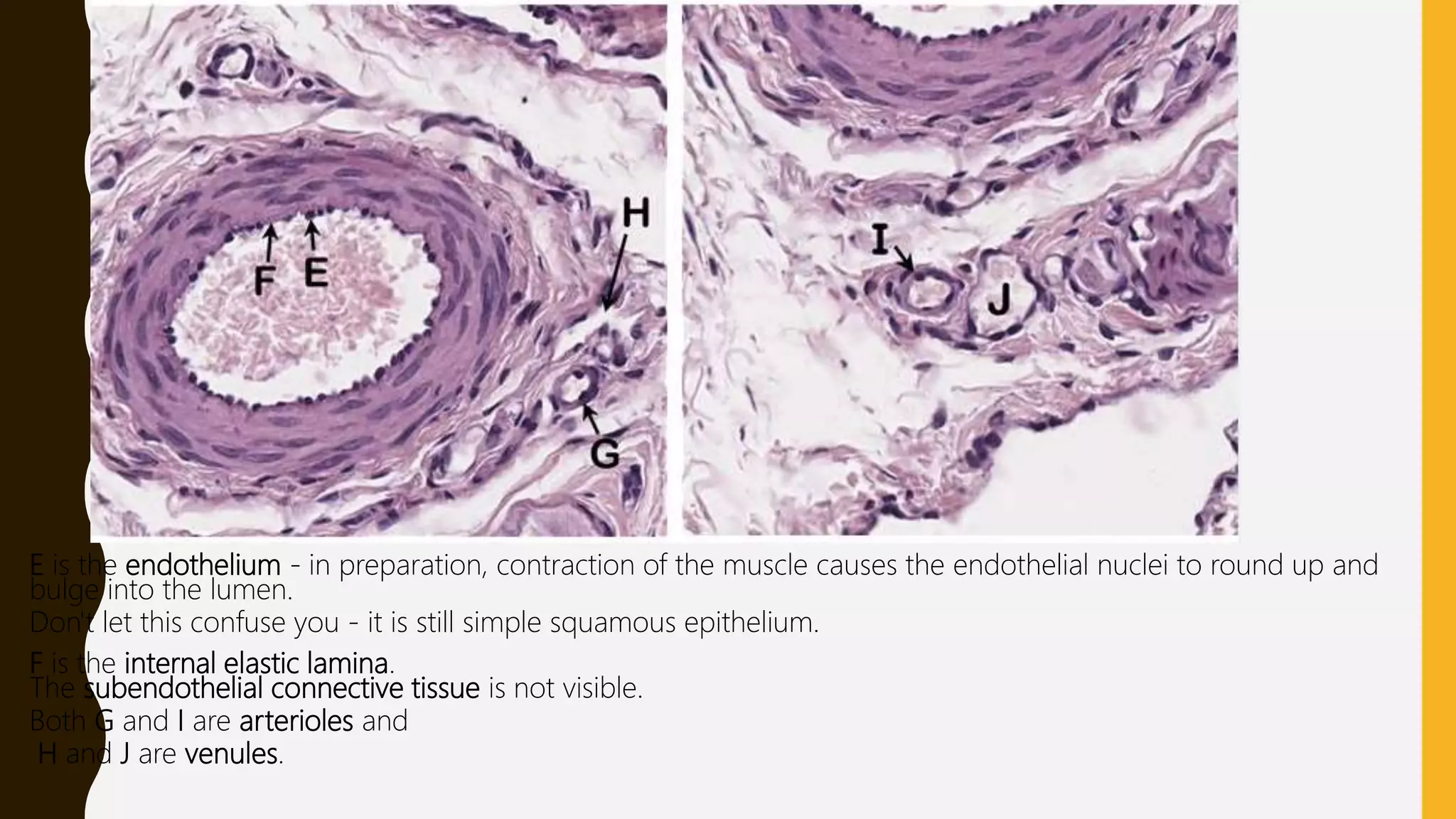 ARTERIES, VENULES, CAPILLARIES | PPTX
