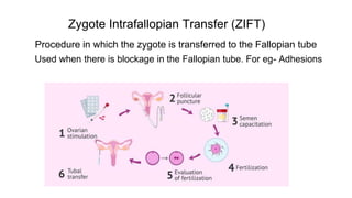 ART obg symposium.22.pptx