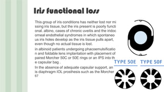 Art of iris repair ppt | PDF