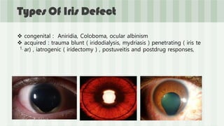 Art of iris repair ppt | PPT