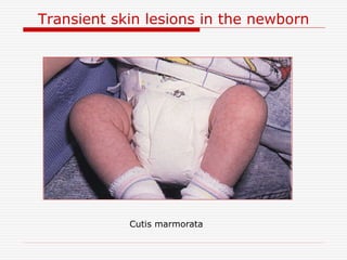 ART OF NEONATAL EXAMINATION & DANGER SIGNS.ppt