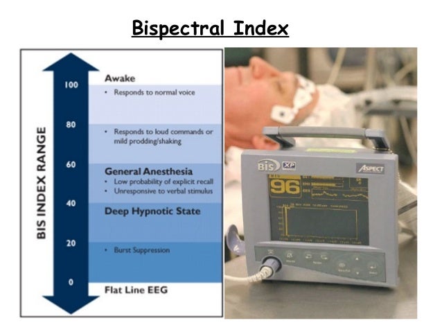 Art of sedation in icu