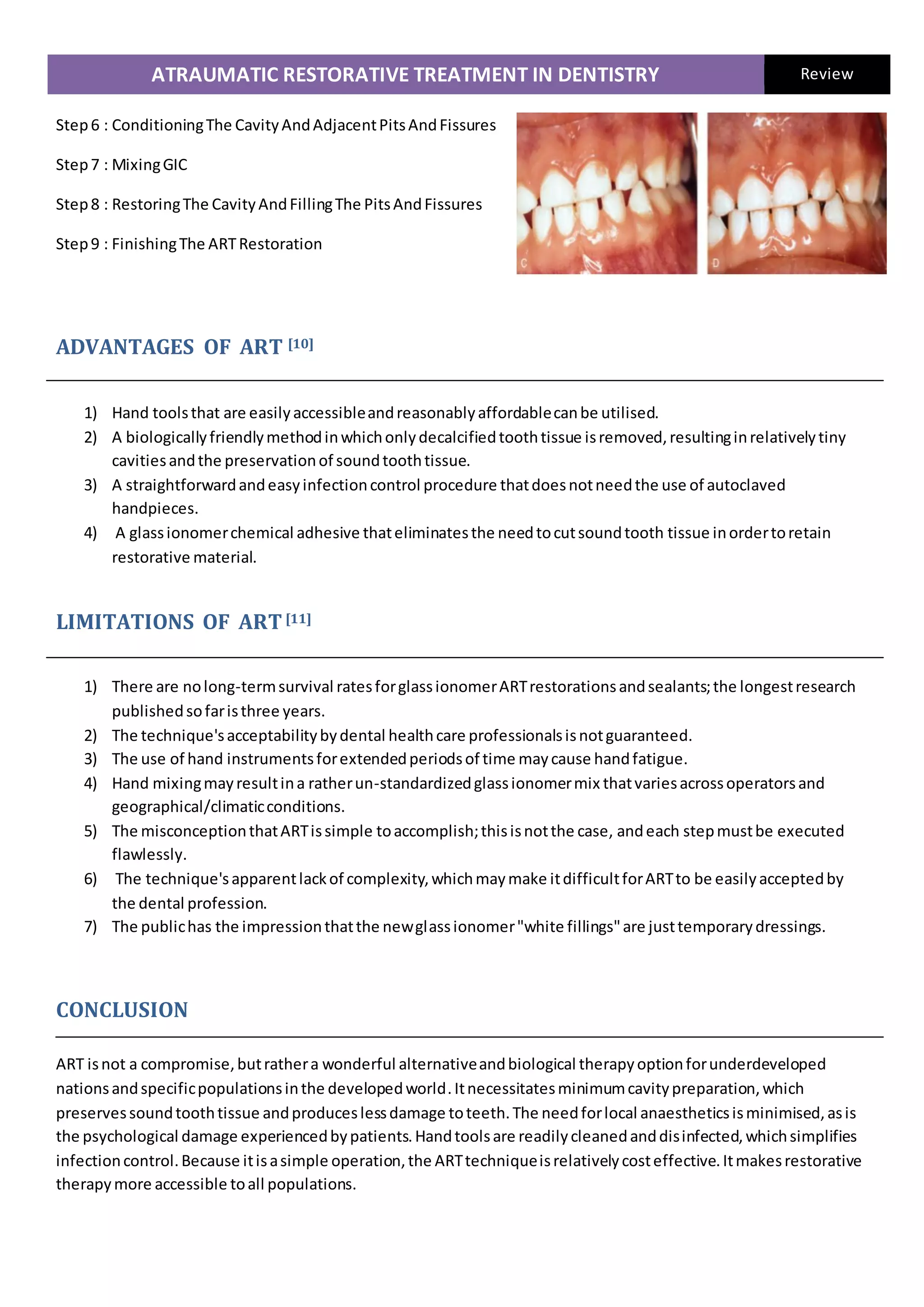 Atraumatic Restorative Treatment : A Review | PDF