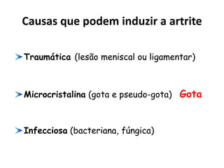 Artrite | PPTX