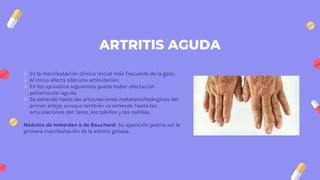 Artritis Gotosa.pptx