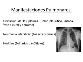 Artritis reumatoide | PPSX