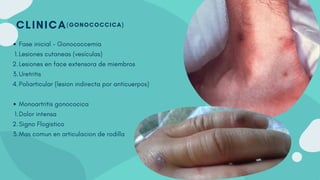 Artritis Séptica y Osteomielitis | PDF