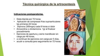 Artrocentesis.pptx