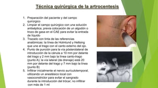 Artrocentesis.pptx