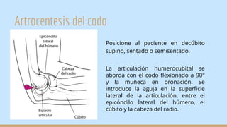ARTROCENTESIS traumatologia y ortopedia.pptx