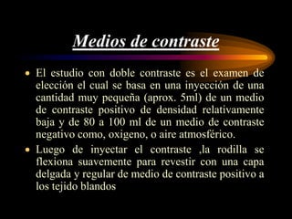 Artrografia.ppt