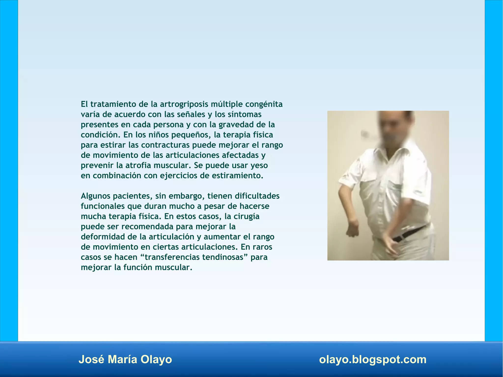 Artrogriposis múltiple congénita. | PDF | Bone and Joint Conditions ...