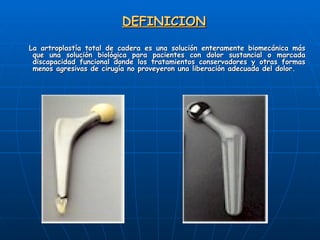 ARTROPLASTIA DE CADERA, para kinesiologia | PPT